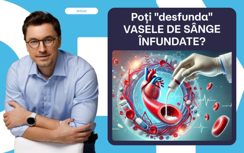 Ai vase de sânge înfundate? Tot ce trebuie să știi | Partea I - Dr. Mihail